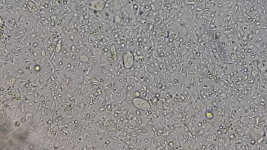 Giardia Lamblia in Drinking Water: Risks and Prevention Methods - DROP